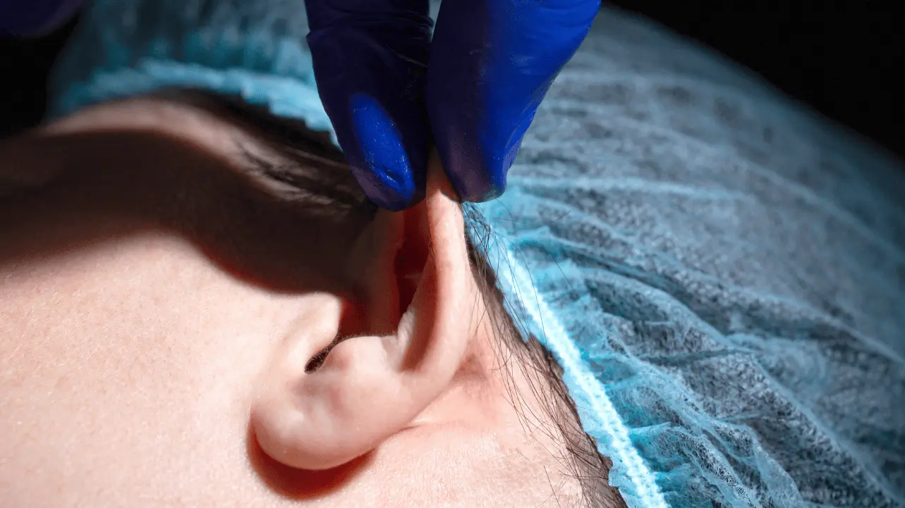 Best Earlobe Repair Surgery in Hyderabad | Ear Hole Stitching Near Me